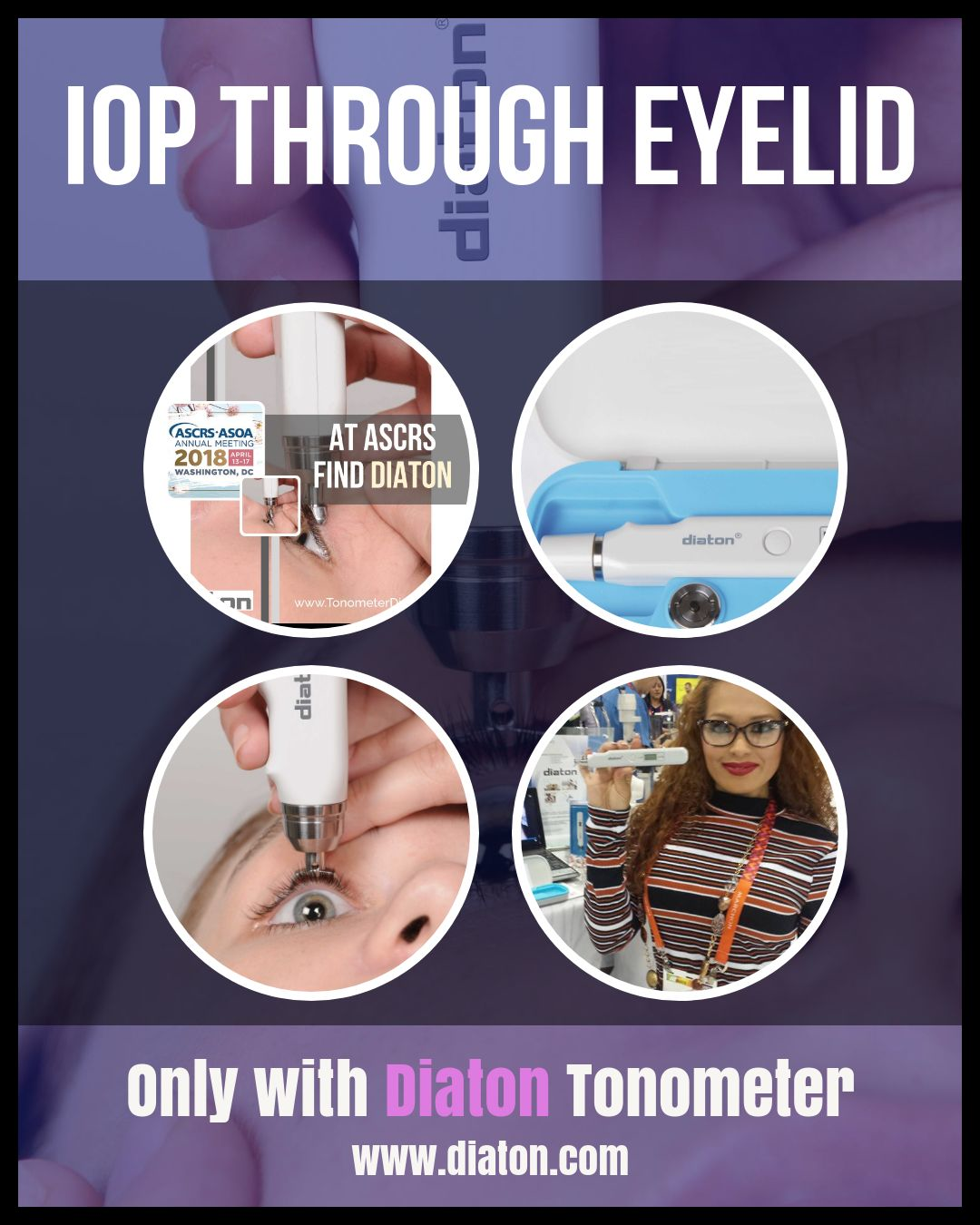 IOP through Eyelid with Diaton Tonometer – Tonometer Diaton