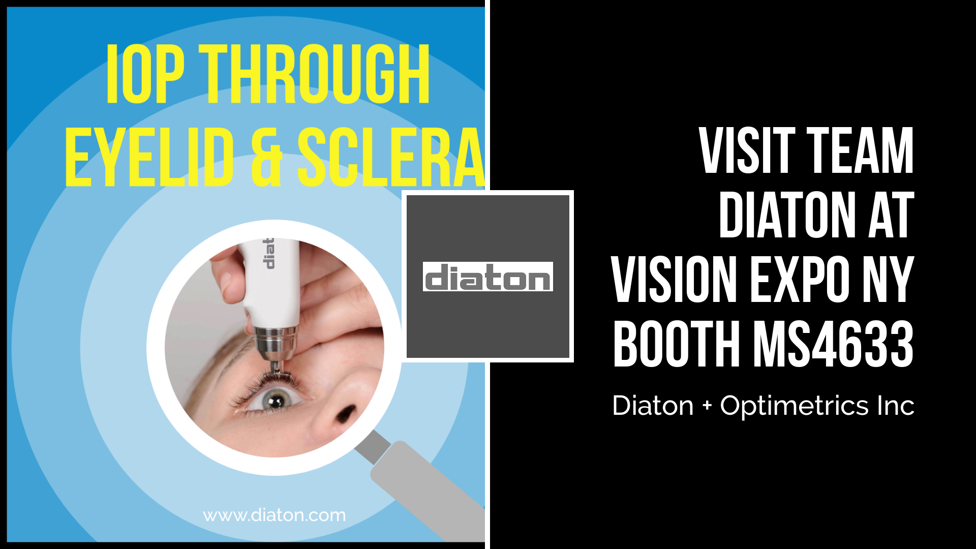 Sight Saving DIATON through Eyelid Tonometer Shows an Innovative Way to ...