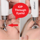Tonometer DIATON Eye Tonometer - IOP through Eyelid & Sclera Tonometry
